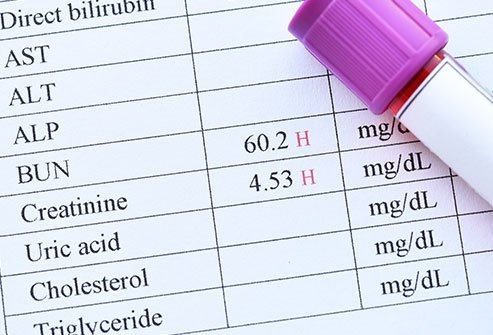 O que é creatinina e por que os níveis de creatinina no sangue são ...